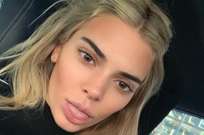 ‘Exploded’ lips? Kendall Jenner made fans speculate about fillers