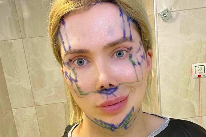 British influencer Oli London became a transgender woman